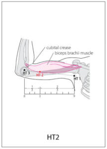 HT 2 Acupuncture Point - Acupuncture Point Locations Review