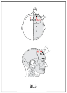 BL 5 Acupuncture Point - Acupuncture Point Locations Review