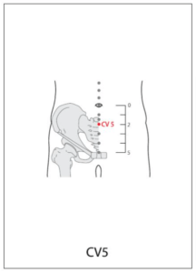 CV 5 Acupuncture Point - Acupuncture Point Locations Review