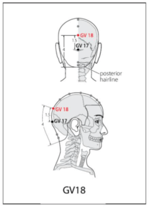GV 18 Acupuncture Point - Acupuncture Point Locations Review